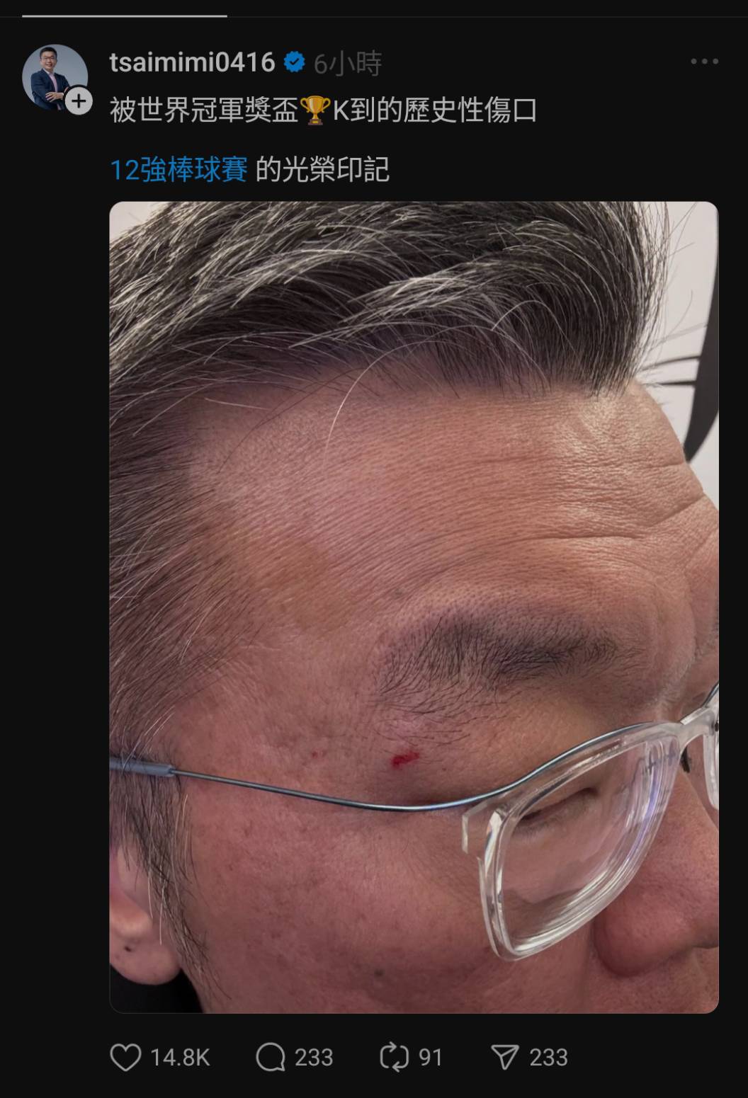 12強賽》被冠軍砸傷稱「光榮印記」 蔡其昌證實獎盃會巡迴展出 - TSNA體育新聞團隊